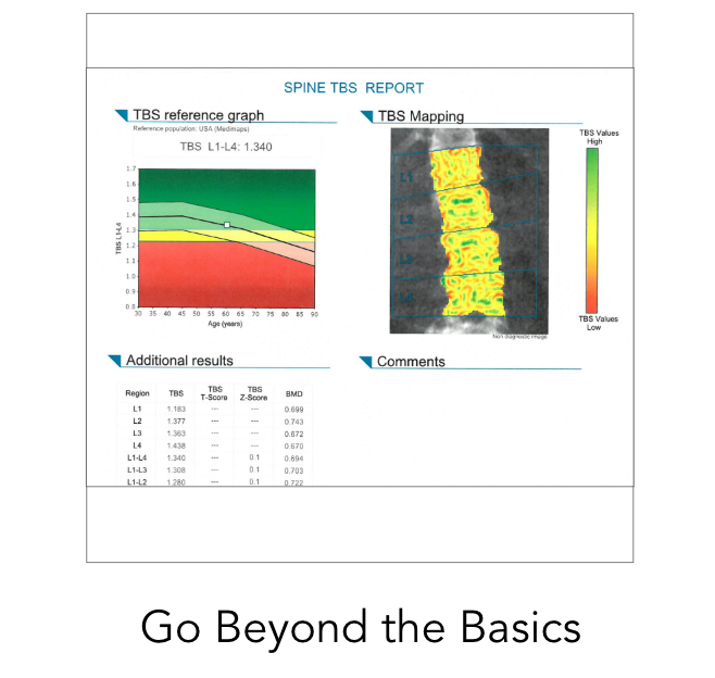 Dr. Lani Simpson DC, CCD - Osteoporosis & Bone Health Expert, Author
